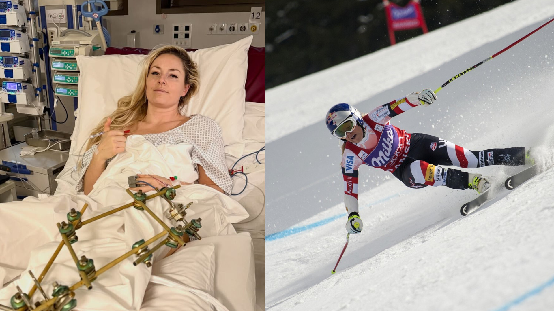 Die amerikanische Skifahrerin Lindsey Vonn unterzieht sich der dritten ...